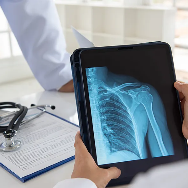 Digital X-Ray - Spectra Diagnostics